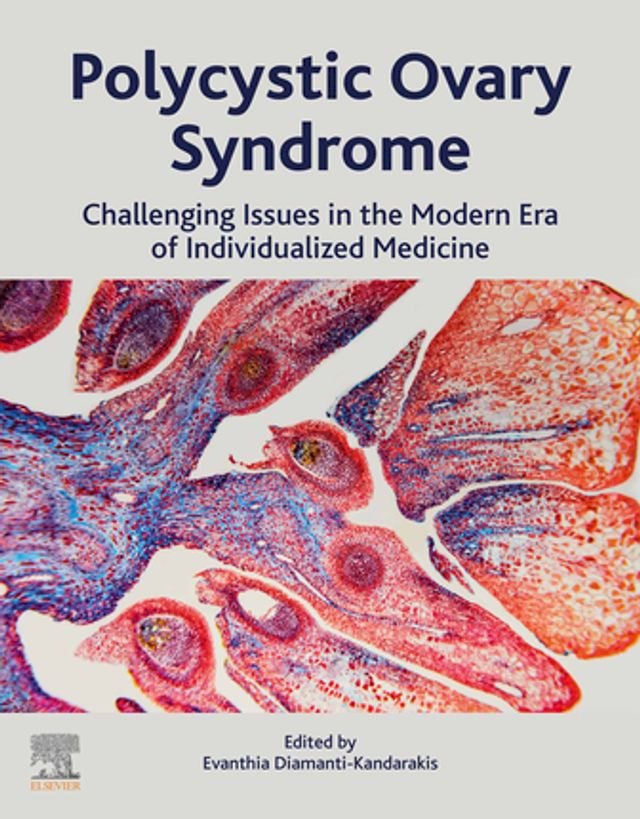 Polycystic Ovary Syndrome - PChome 24h書店