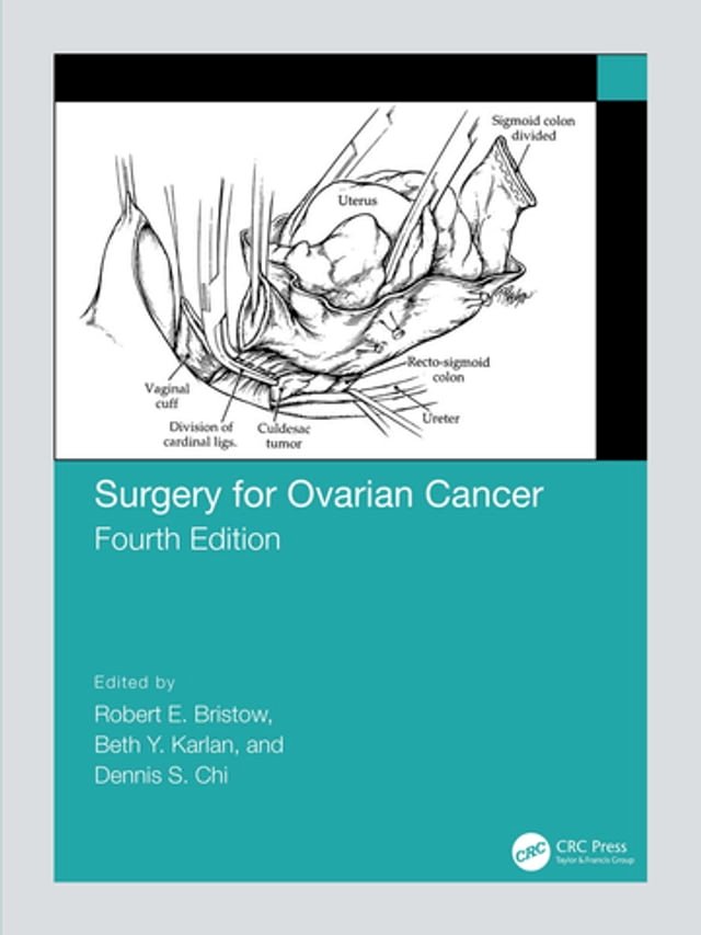 Surgery for Ovarian Cancer - PChome 24h書店